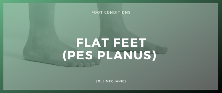 Flat Feet (Pes Planus) | Foot Conditions | Sole Mechanics – Sole ...